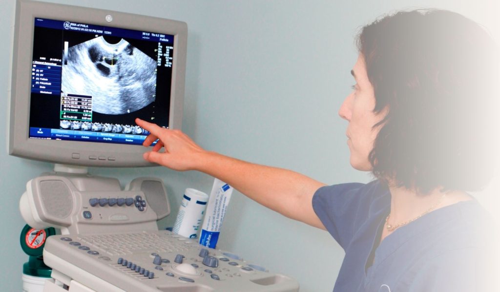 Ultrasound Fertility Testing | RMA Network - Fertility Clinic